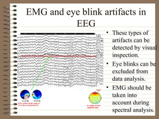Eeg examples | PPT