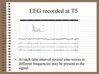 Eeg examples | PPT