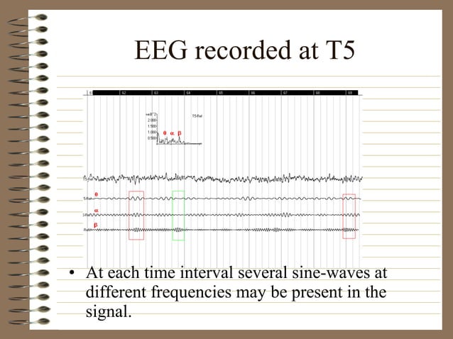 Eeg examples | PPT