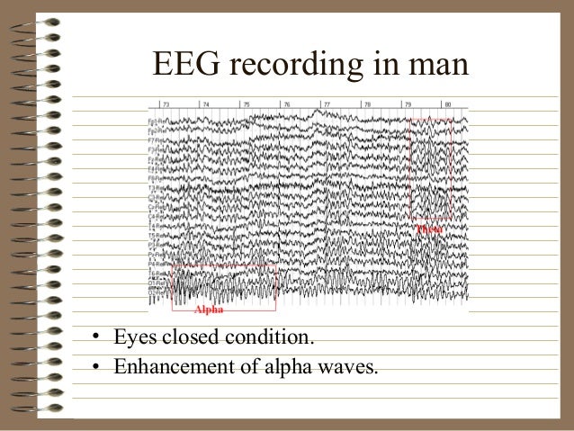 Eeg examples