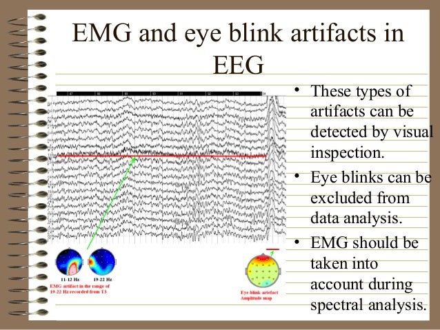 Eeg examples