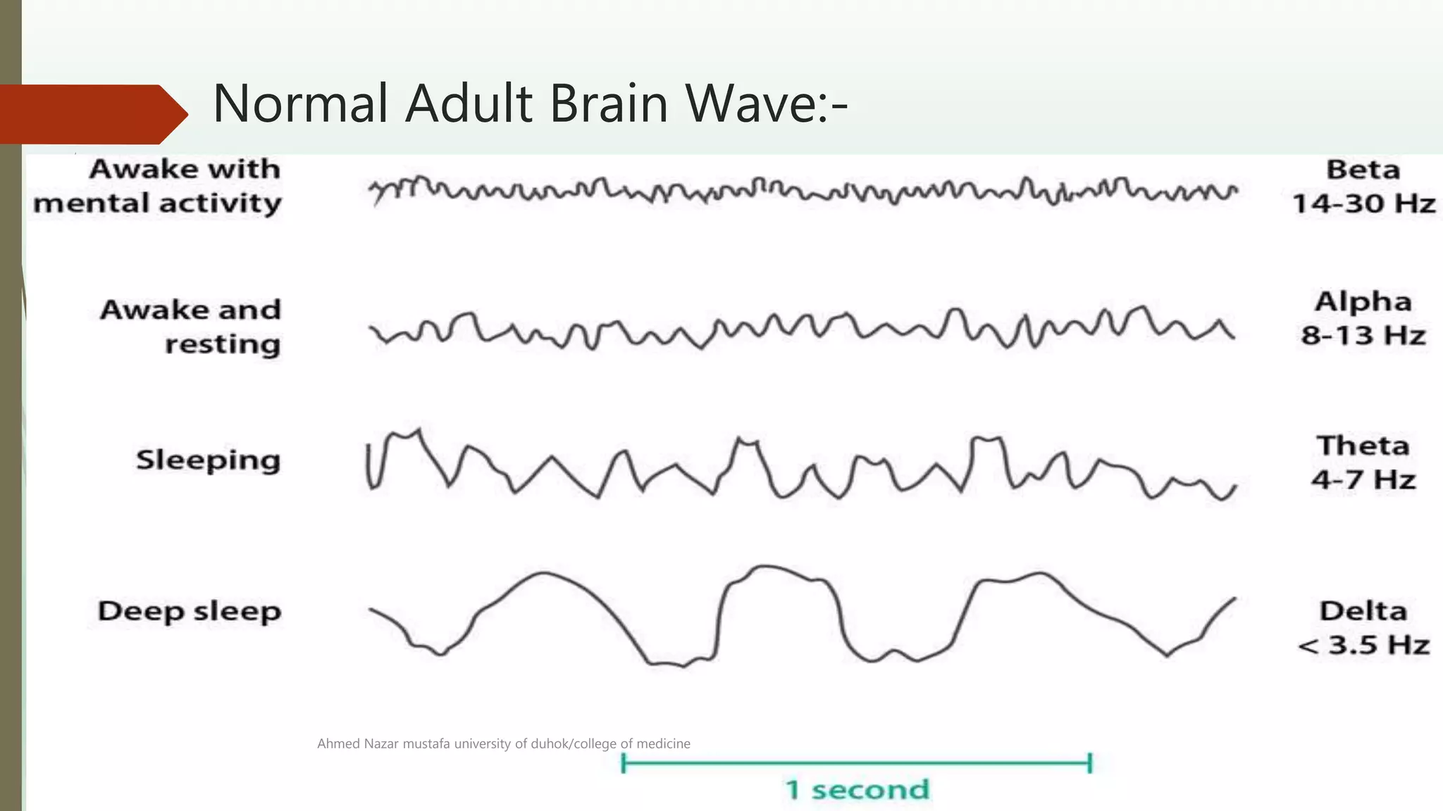 EEG (electroencephalogram) | PPTX