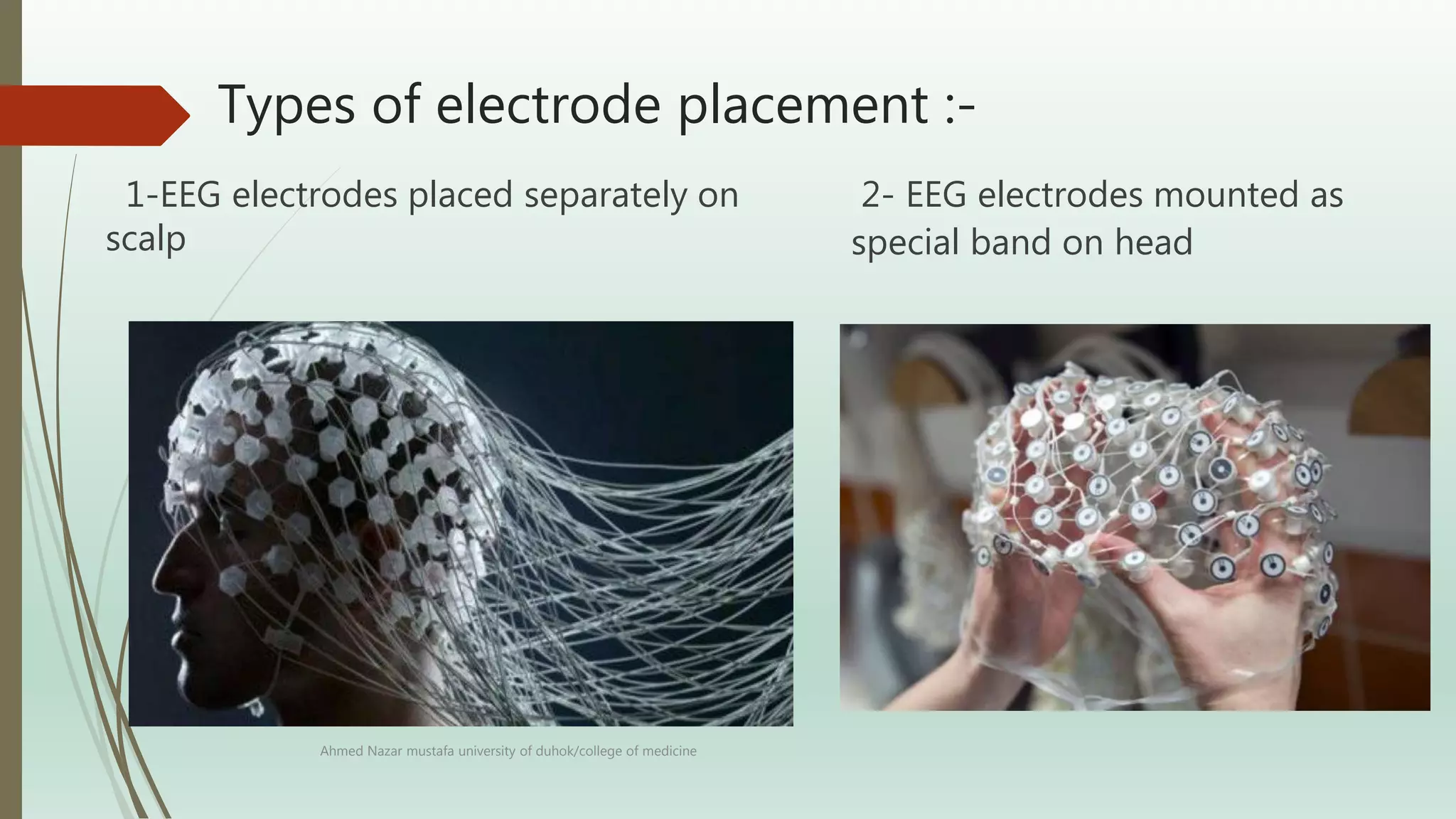 EEG (electroencephalogram) | PPTX