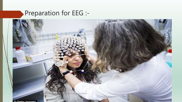 EEG (electroencephalogram) | PPTX | Brain and Nervous System Disorders | Diseases and Conditions