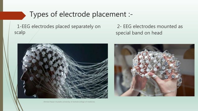 EEG (electroencephalogram) | PPTX | Brain and Nervous System Disorders | Diseases and Conditions