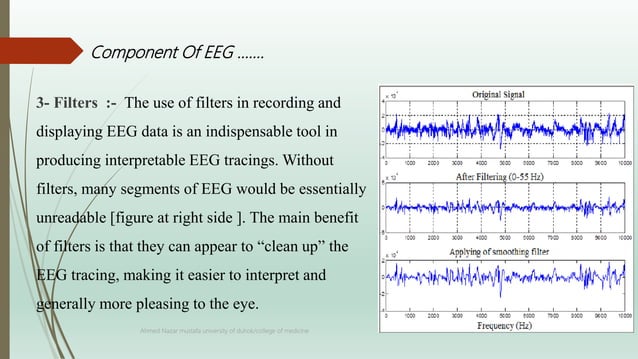 EEG (electroencephalogram) | PPTX | Brain and Nervous System Disorders | Diseases and Conditions