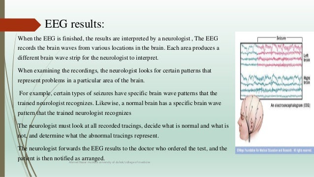 Electroencephalogram Eeg Uses Procedure Results