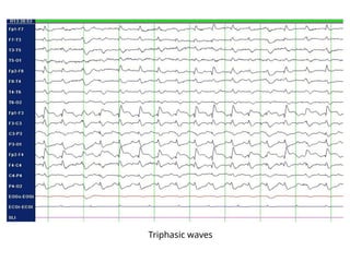ELECTROENCEPHALOGRAM FOR PSYCHIATRIC PGS.pptx