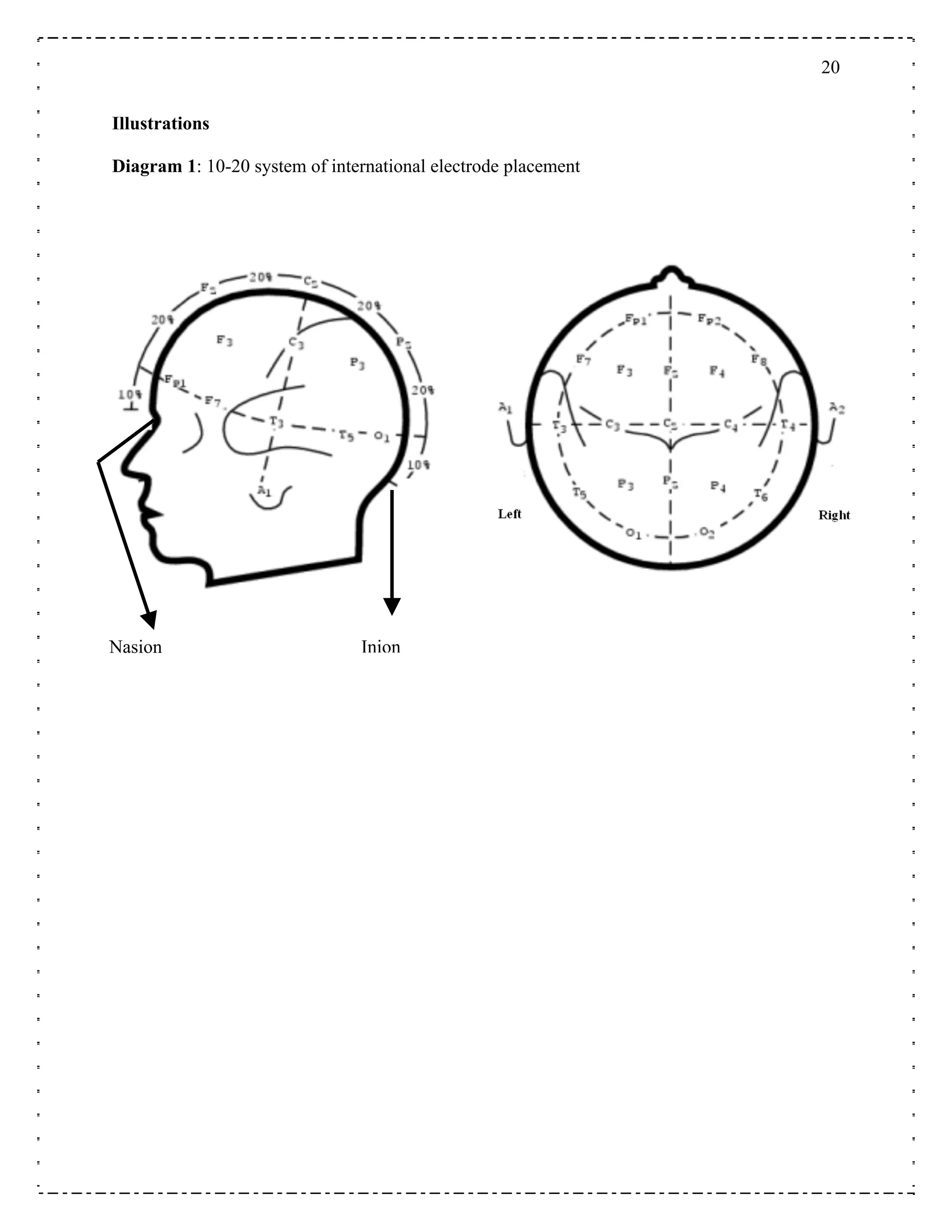 Pediatric EEG - by Dr.Rajesh Ramachandran Nair | PDF