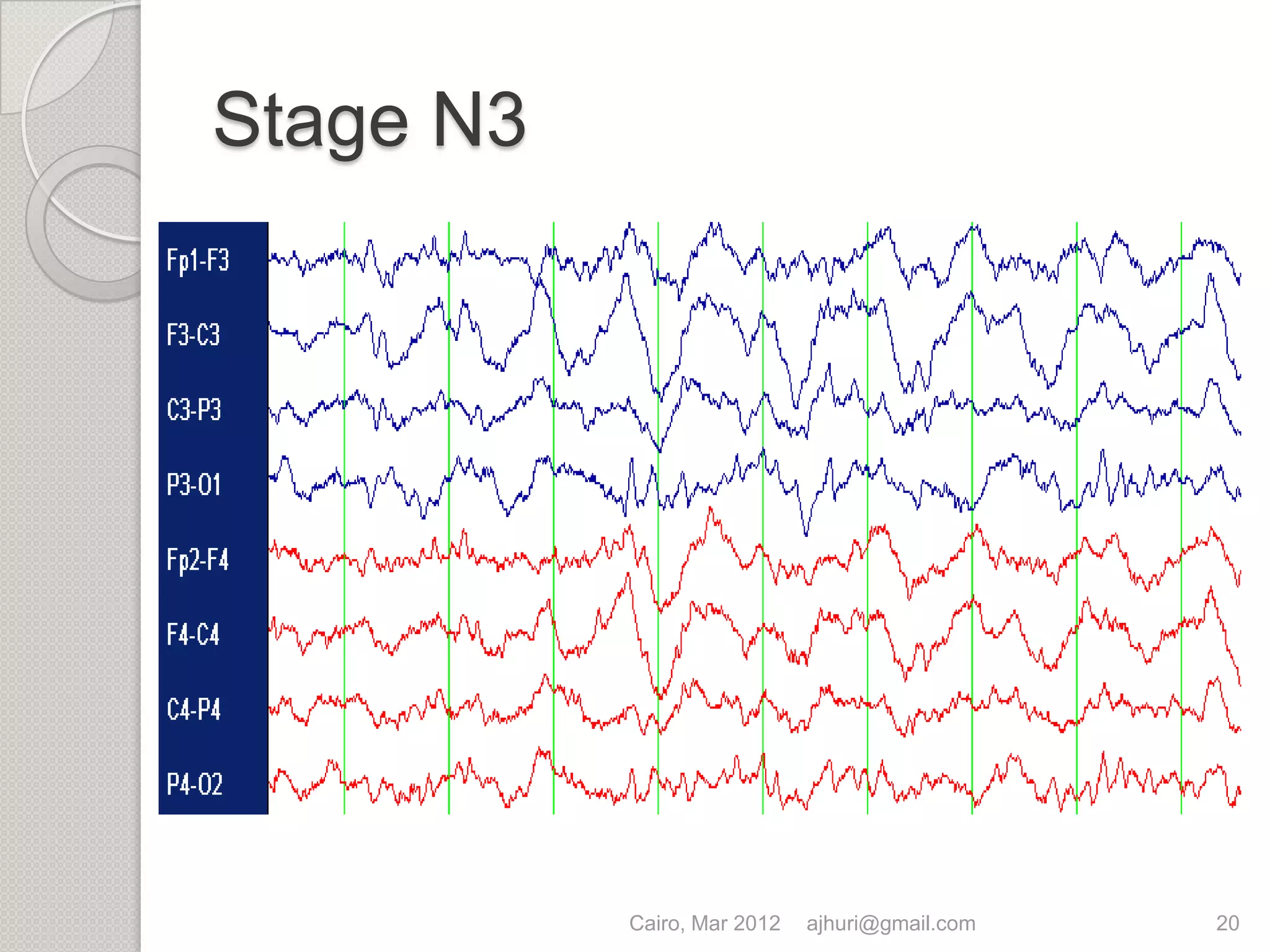 EEG for sleep lab | PPTX