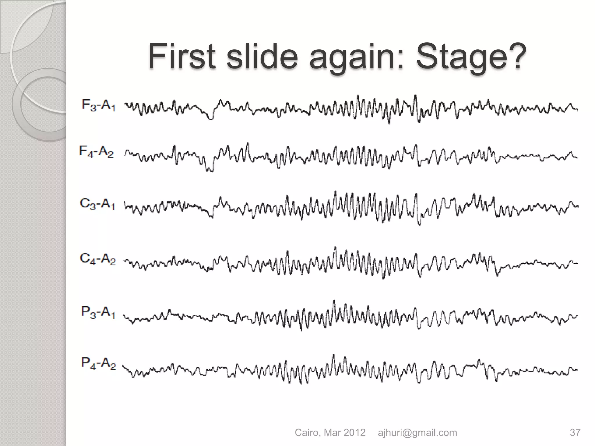 EEG for sleep lab | PPTX