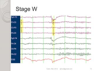 EEG for sleep lab | PPTX