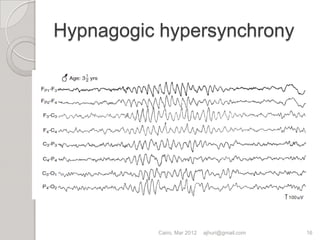 EEG for sleep lab | PPTX