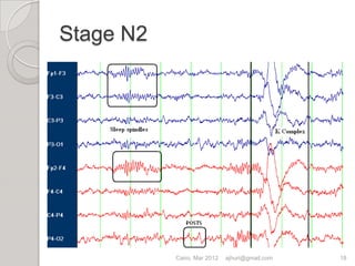 EEG for sleep lab | PPT