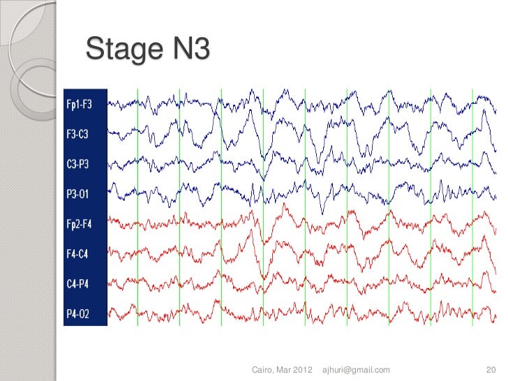 EEG for sleep lab