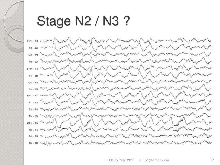 EEG for sleep lab