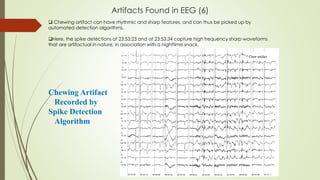 EEG guest lecture_iub_eee541 | PPT