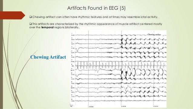EEG guest lecture_iub_eee541