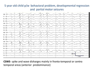 Eeg in enceplopthy | PPT