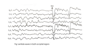 EEG Lecture 2.pptx