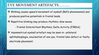 EEG Lecture 3: Artifacts and Benign EEG variants | PPTX