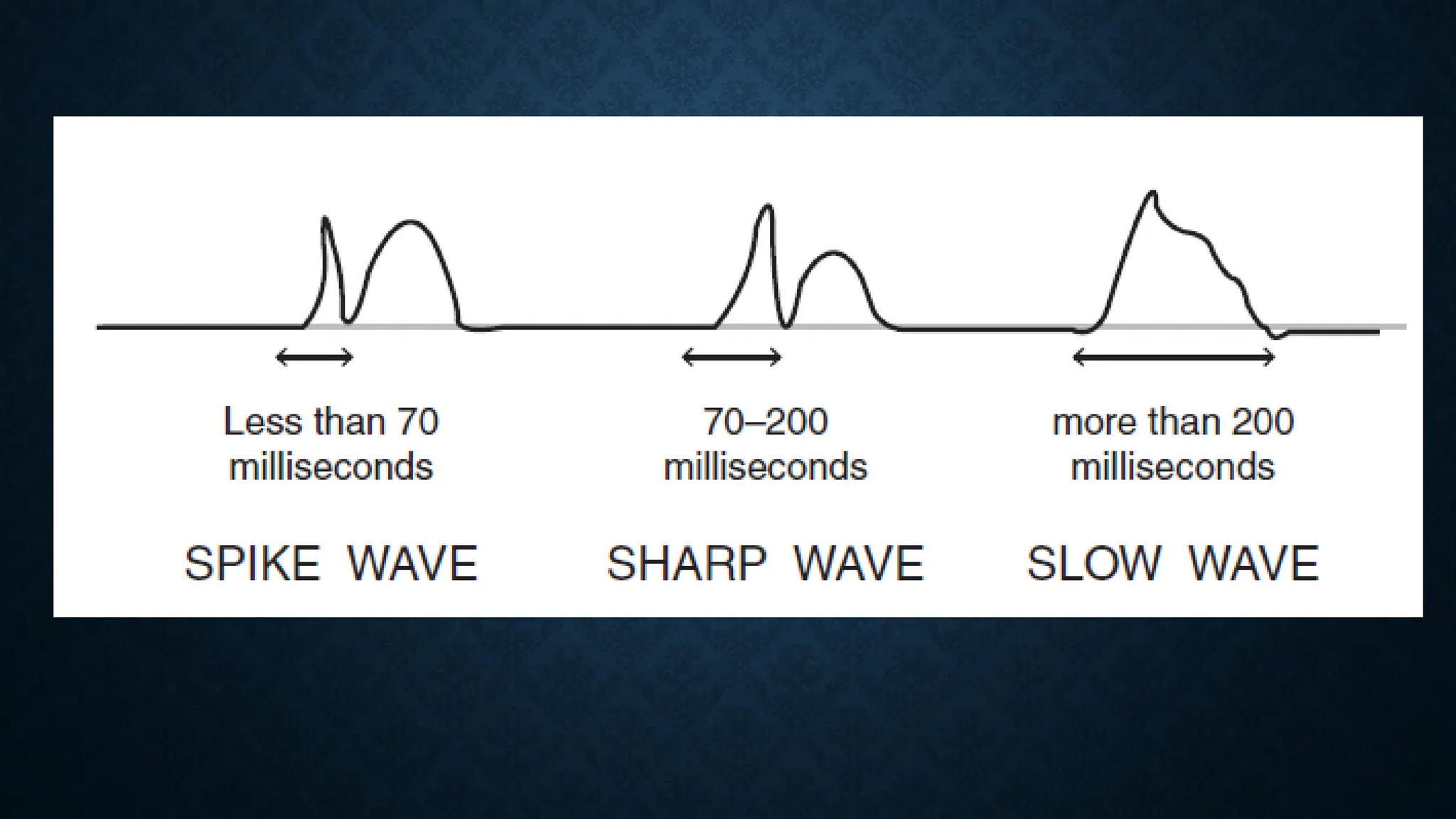 Epileptiform EEG abnormalities in adults and children | PPTX