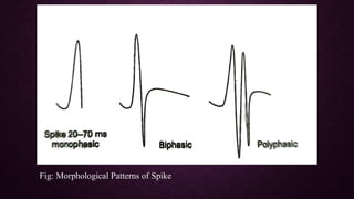 Epileptiform EEG abnormalities in adults and children | PPTX