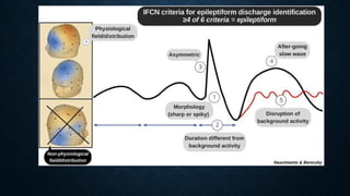 Epileptiform EEG abnormalities in adults and children | PPTX