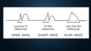 Epileptiform EEG abnormalities in adults and children | PPTX