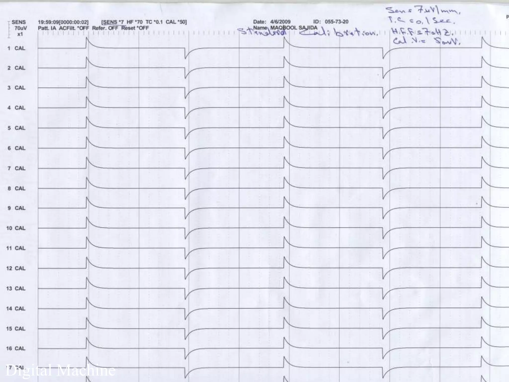 Eeg machine calibration | PPTX