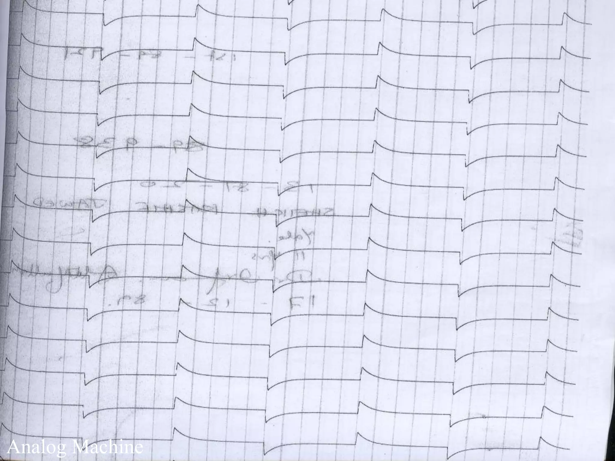 Eeg machine calibration | PPTX