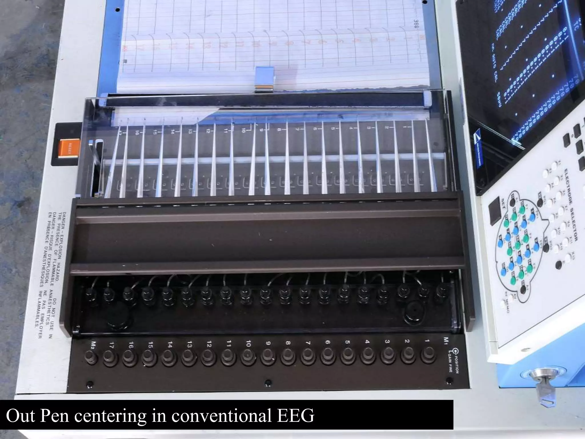 Eeg machine calibration | PPTX