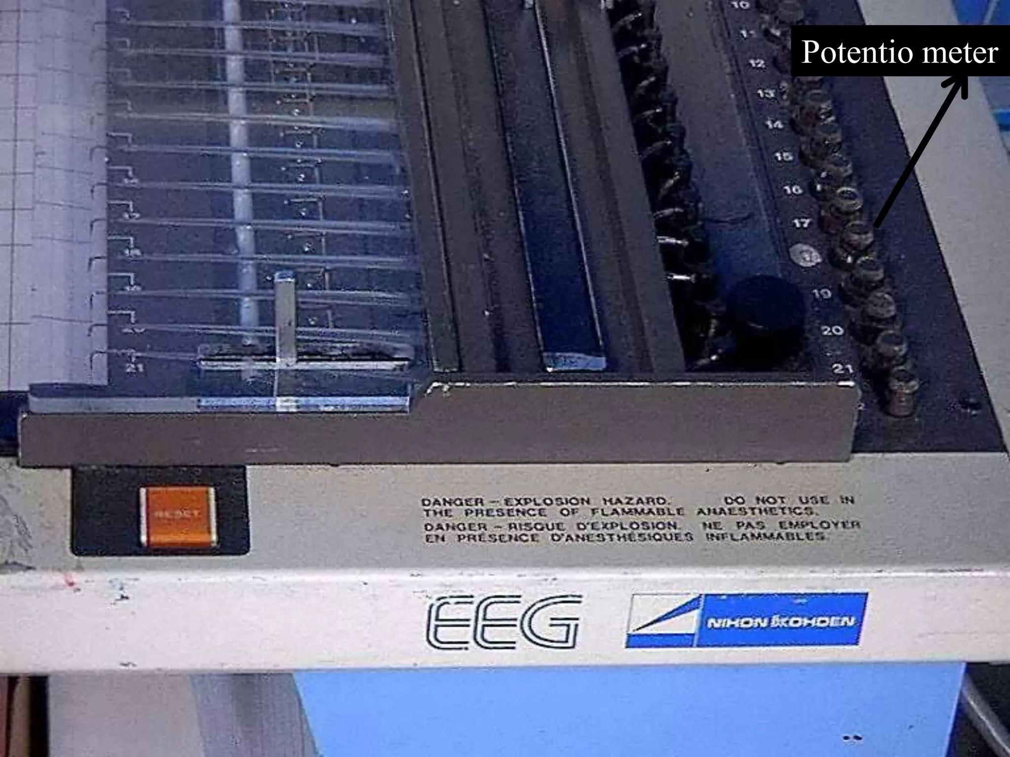 Eeg machine calibration | PPTX