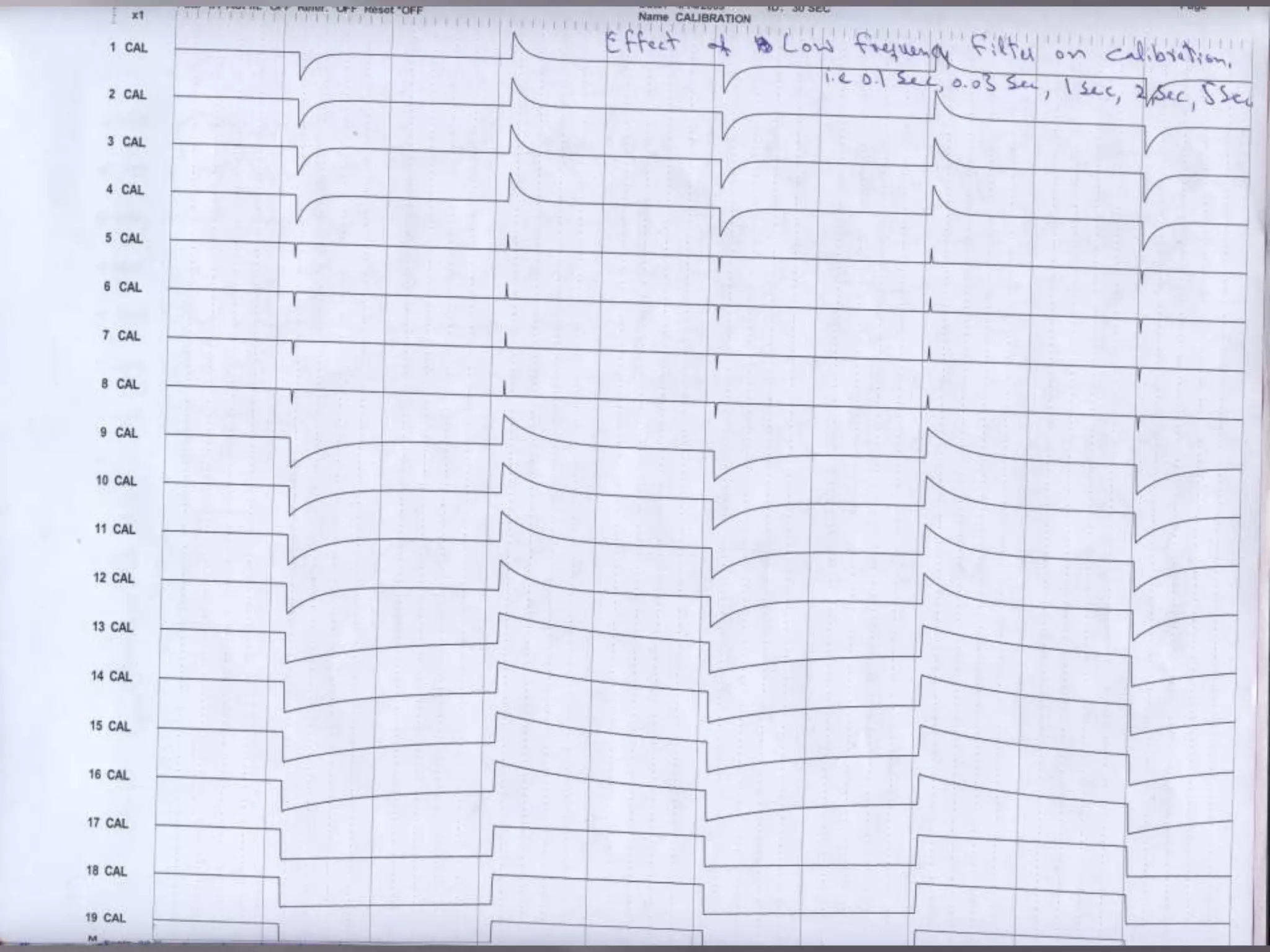 Eeg machine calibration | PPTX