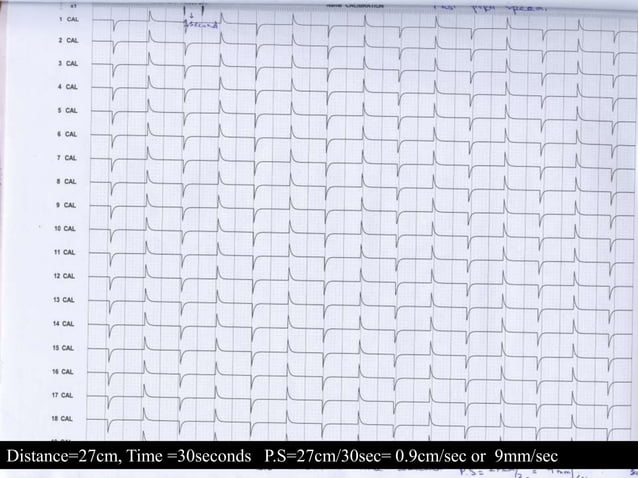 Eeg machine calibration | PPT