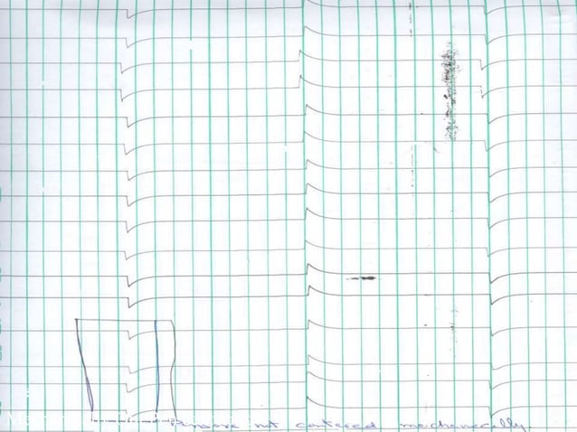 Eeg machine calibration | PPTX