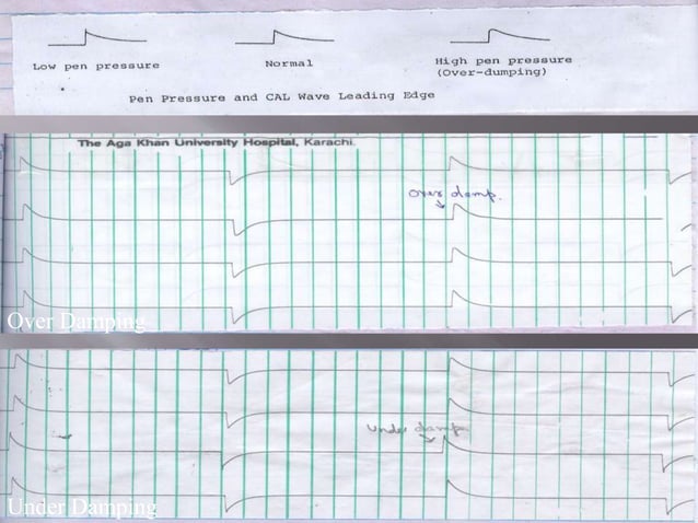 Eeg machine calibration | PPTX