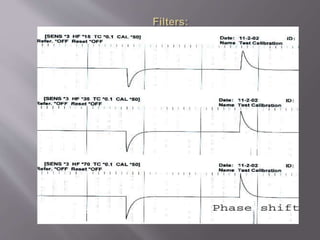 Eeg machine calibration | PPTX