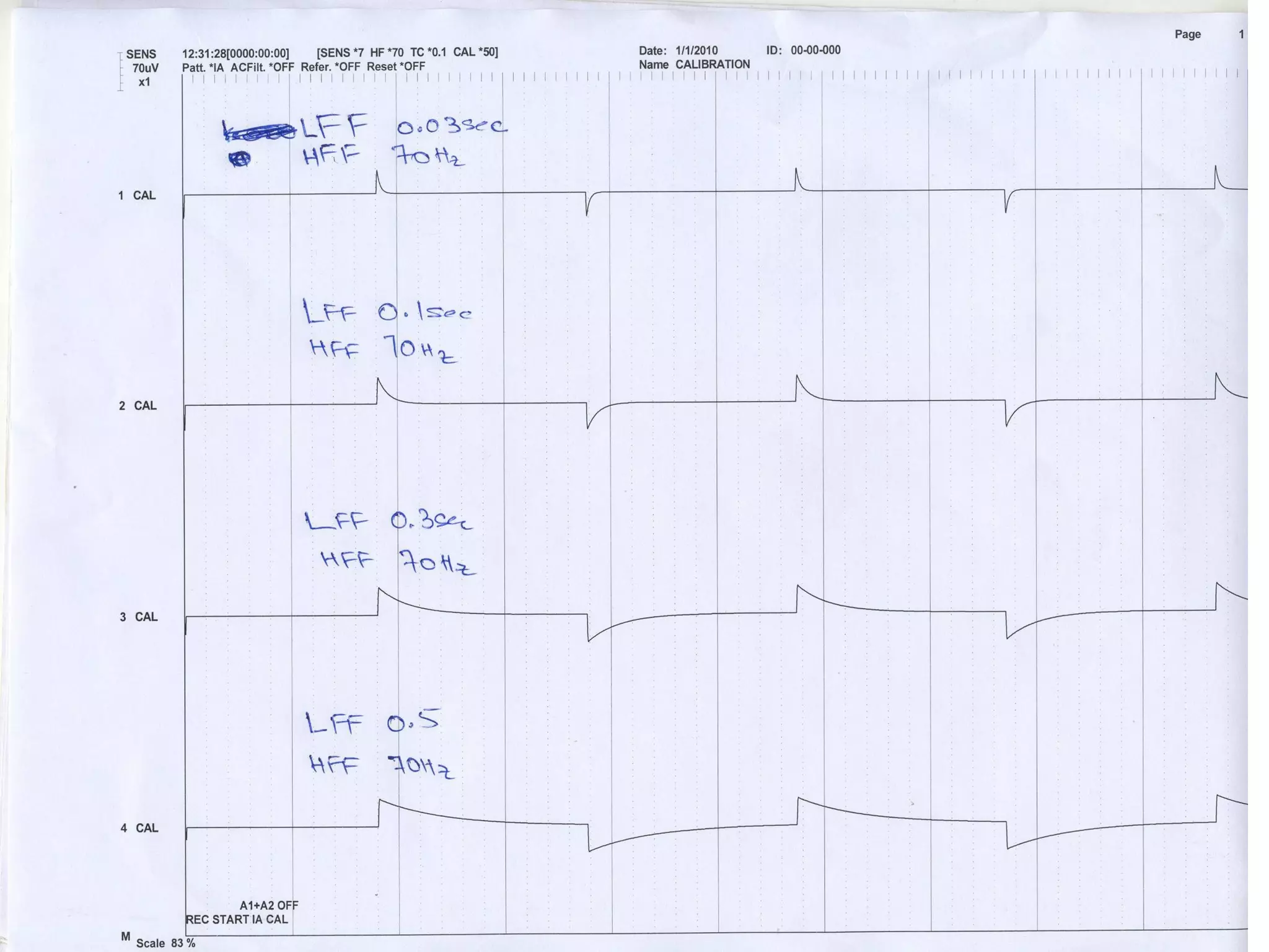 Eeg machine filters | PPT