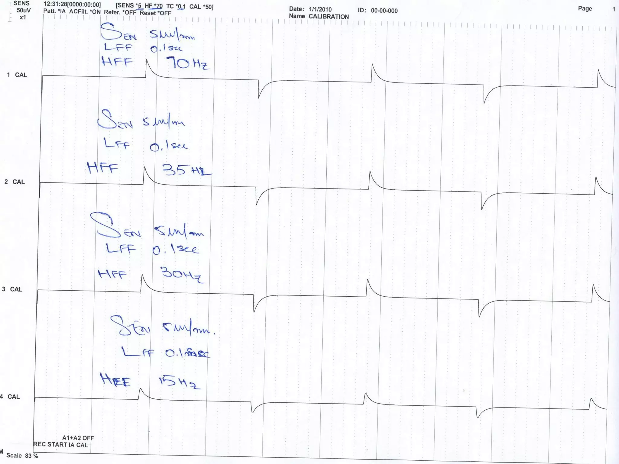 Eeg machine filters | PPT