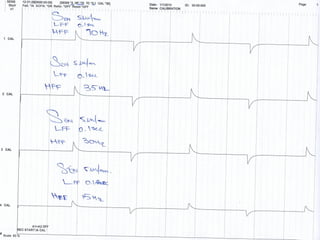 Eeg machine filters | PPT