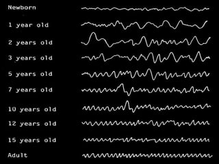 EEG Maturation - Serial evolution of changes from Birth to Old Age | PPT