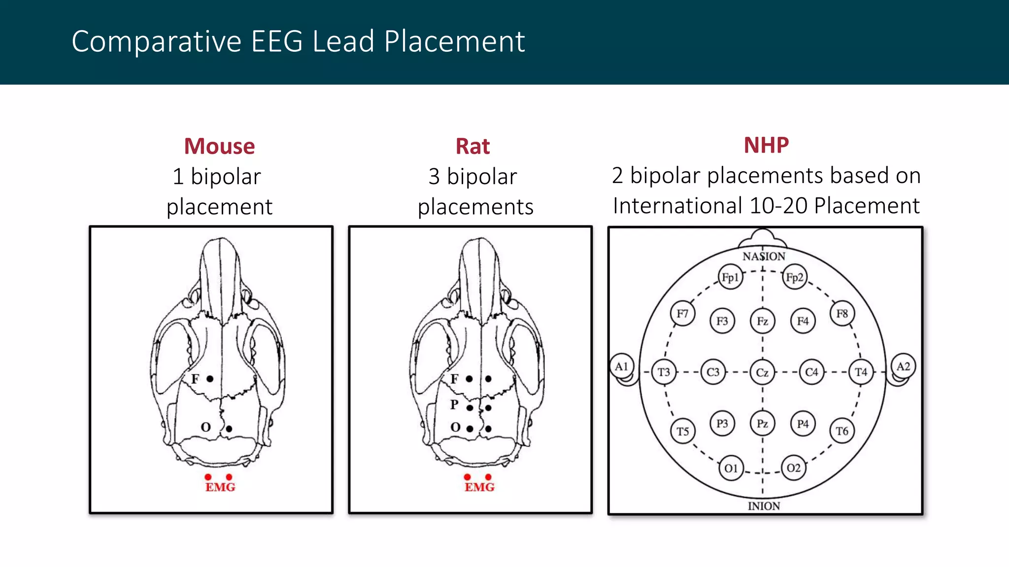 Harnessing EEG Methods to Improve Basic and Translational Research for ...