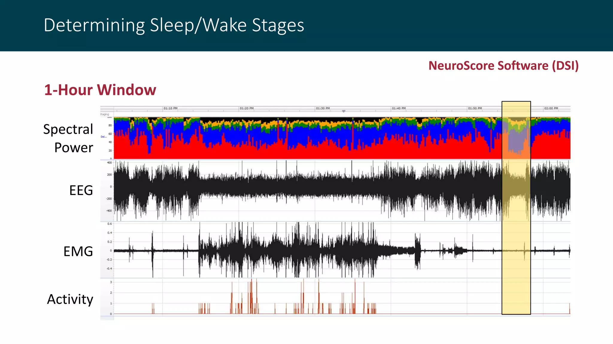 Harnessing EEG Methods to Improve Basic and Translational Research for ...
