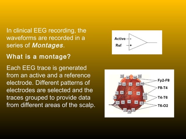 EEG - Montages, Equipment and Basic Physics | PPT | Chemistry | Science