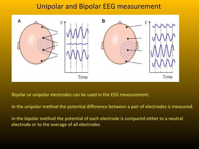 EEG - Montages, Equipment and Basic Physics | PPT | Chemistry | Science