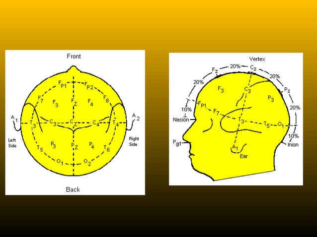 EEG - Montages, Equipment and Basic Physics | PPT | Chemistry | Science