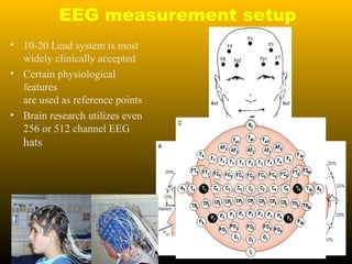 EEG - Montages, Equipment and Basic Physics | PPT