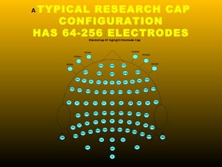 EEG - Montages, Equipment and Basic Physics | PPT