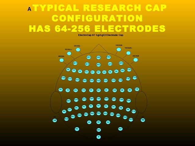 EEG - Montages, Equipment and Basic Physics | PPT | Chemistry | Science